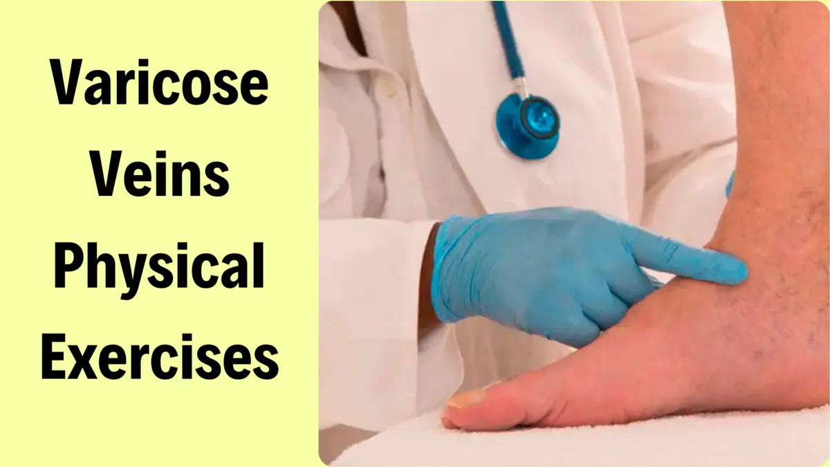10 Best Varicose Veins Physical Exercises - AWAIS MUGHAL